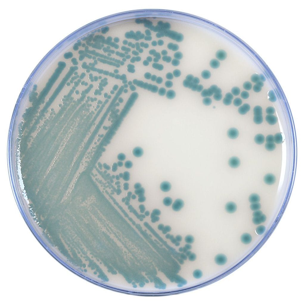 HardyCHROM™ Vibrio, Chromogenic Medium - Pre-poured Ready Agar Plates ...